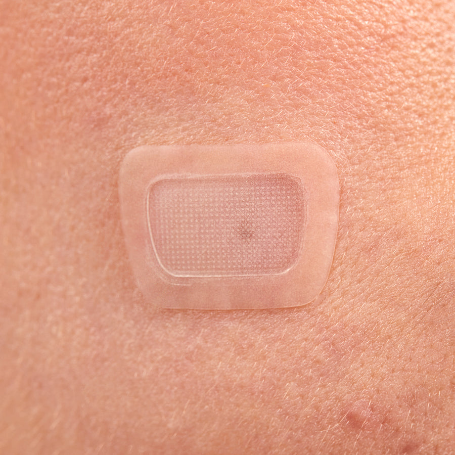 Get Rid of Acne Dark Spots | Microcrystal Dark Spot Cover | Rael