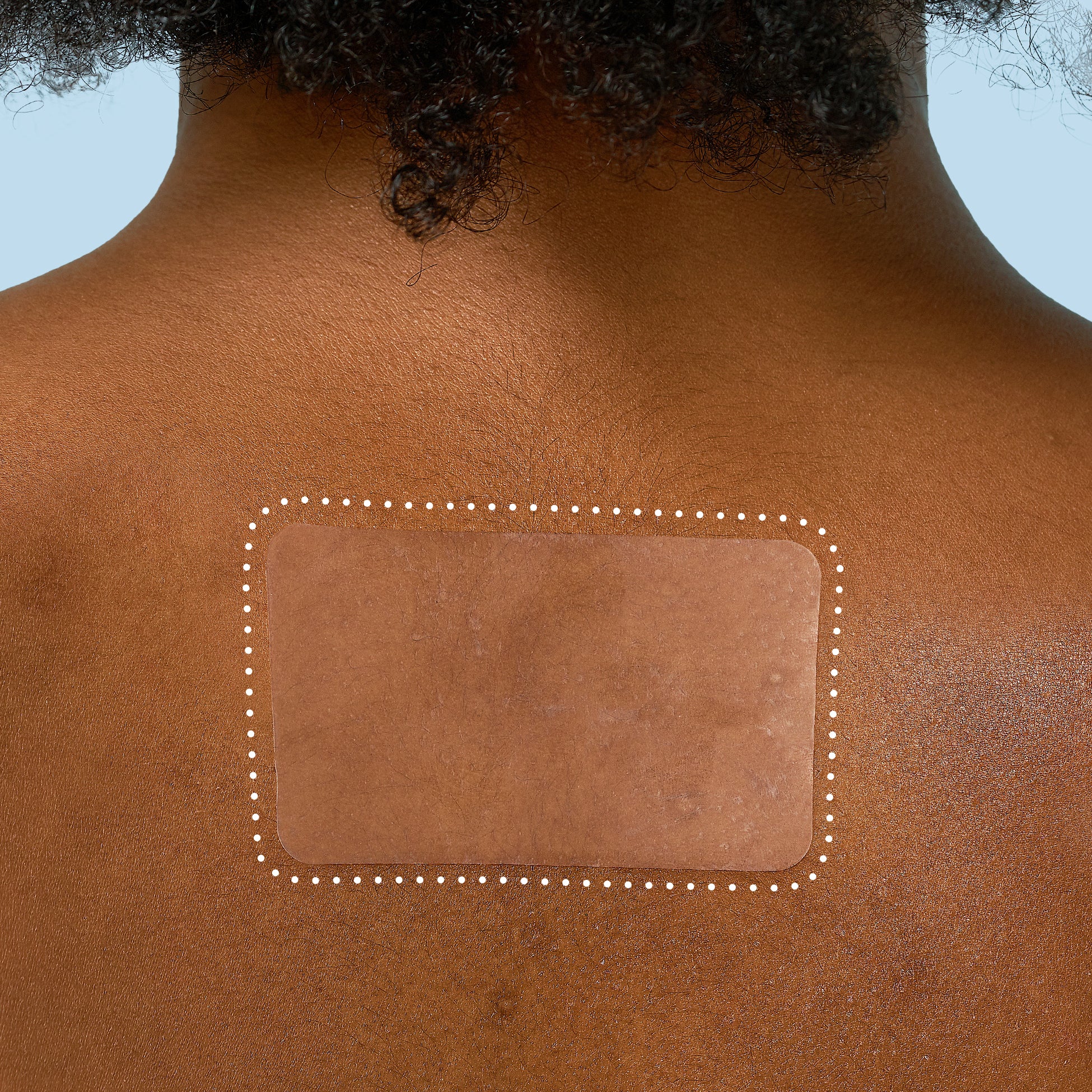 Pimple Patch | XL Spot Control Cover For Body Acne | Rael