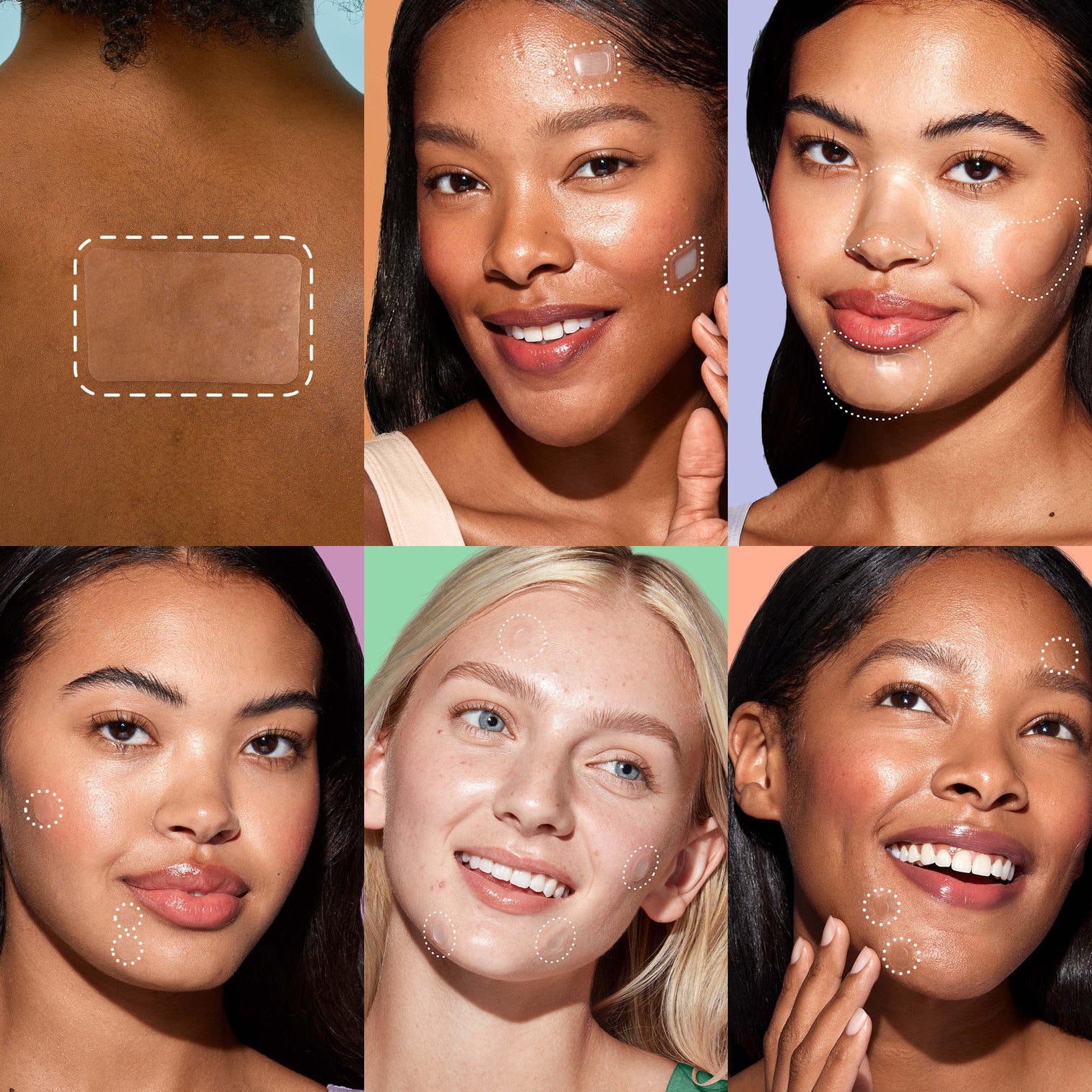 Ultimate Pimple Patch Kit | Rael